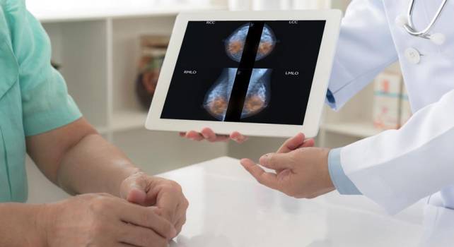 NEOADYUVANCIA: Un enfoque distinto para el manejo del cáncer de mama